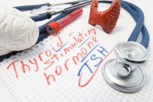 TSH hormon - normalne vrednosti, povišen i nizak TSH - LaboMedica Beograd